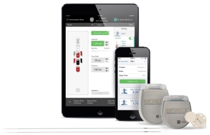 アボット、運動障害に苦しむ患者様向け非充電式Infinity™脳深部刺激用システムとディレクショナルDBSリードの厚生労働省の承認を取得